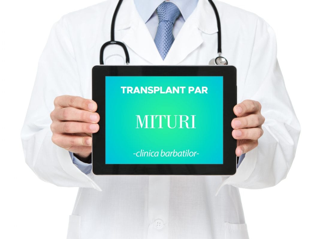 Mituri transplant par - 8 curiozitati lamurite perfect